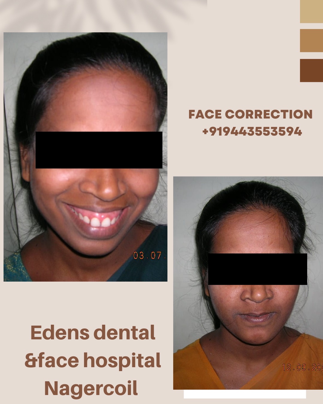 Best Face Plastic Surgeon in India | Top Face Surgery Hospital